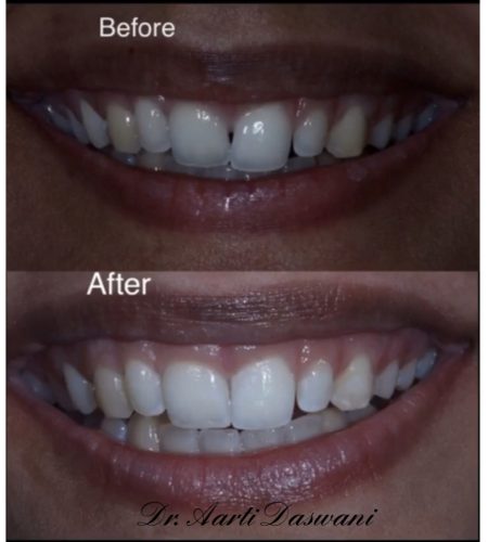 Smile Gallery - Divine Smiles Plus Dental Clinic